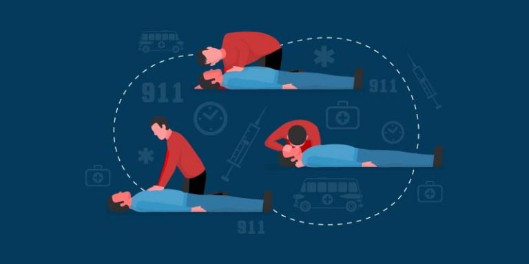 When Should Rescuers Switch Positions During CPR? Key Timing & Tips